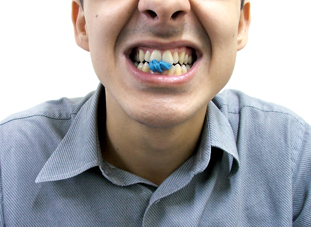 Extractie – Tandarts in Deventer – De #1 | 123 Tandartsen en Orthodontie